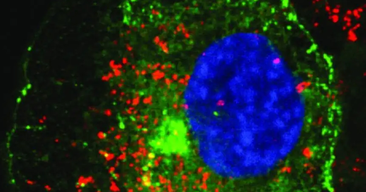 Ricci Lab — Macrophage biology & immunometabolism | IGBMC Strasbourg